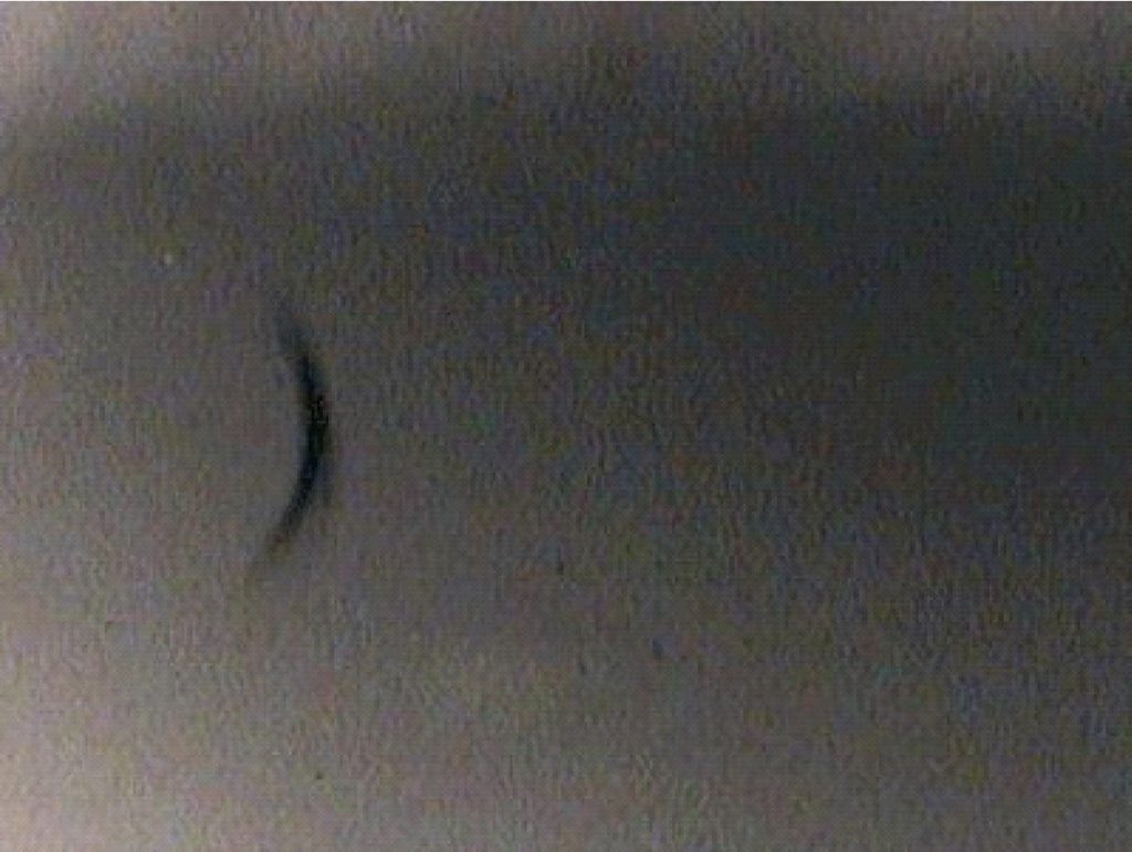 Radiography X ray film Artefacts false Indications