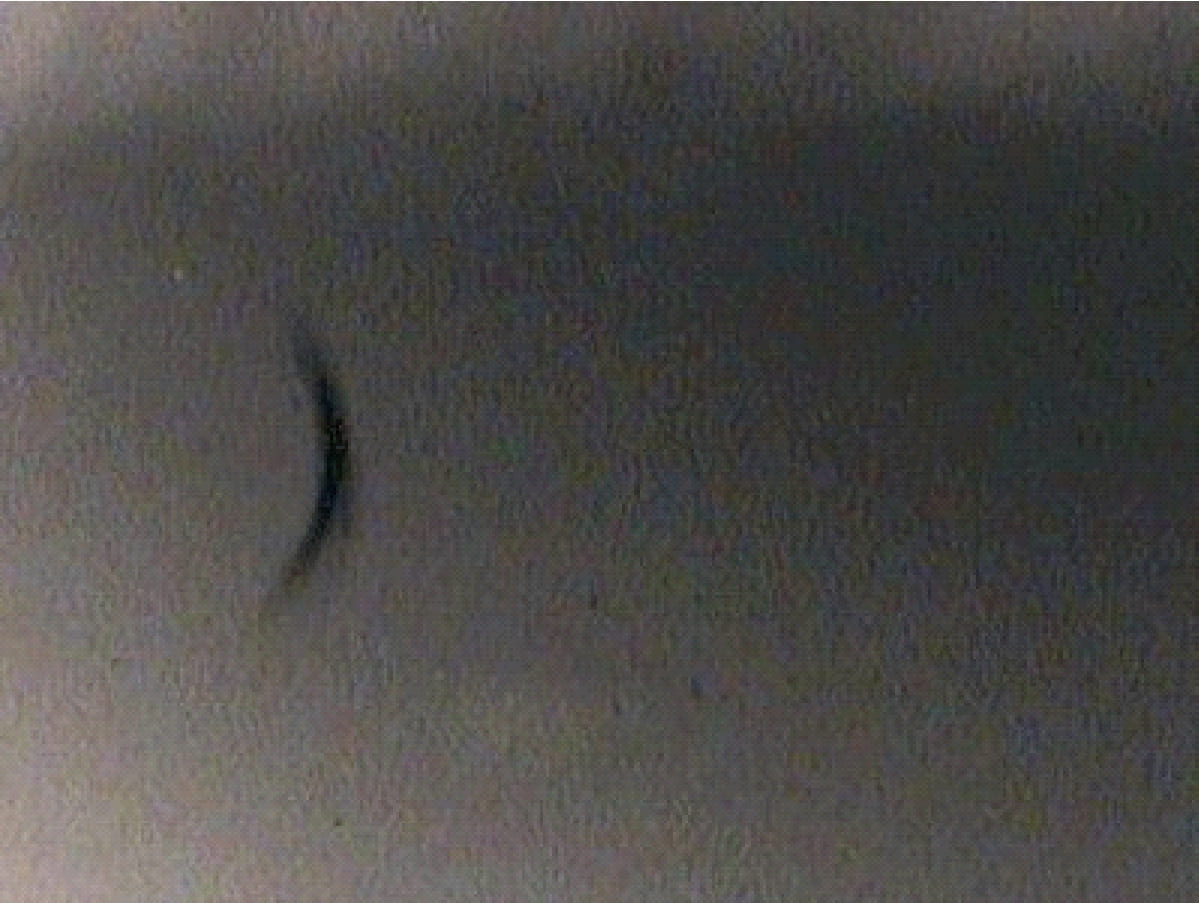 Radiography X ray film Artefacts false Indications