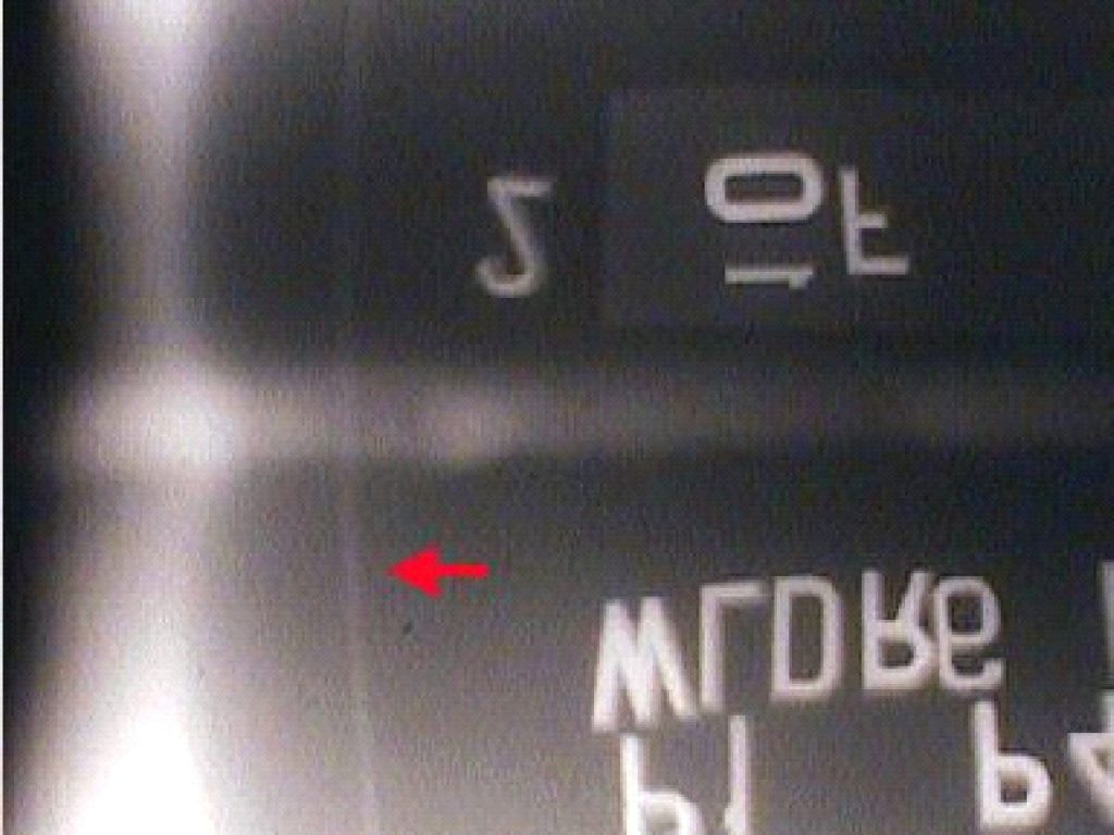 Radiography X ray film Artefacts false Indications