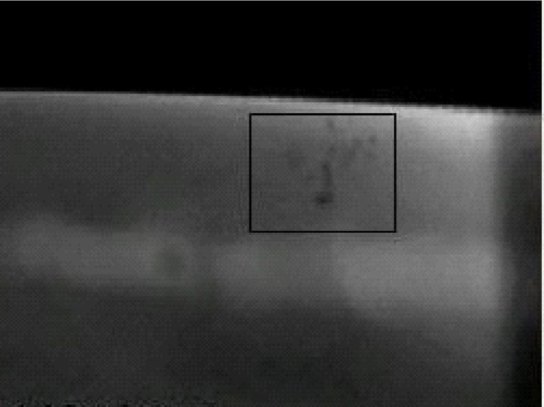 Radiography X ray film Artefacts false Indications