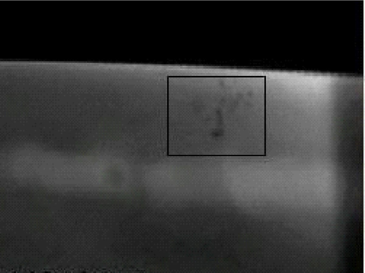 Radiography X ray film Artefacts false Indications